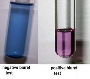 Biuret test: Principle, Requirements, Procedure and Result ...