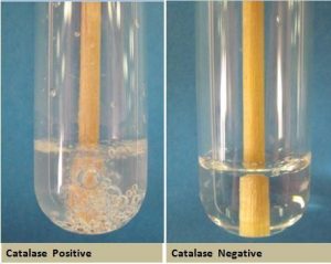 Catalase test (Principle, Procedure, Result interpretation and ...