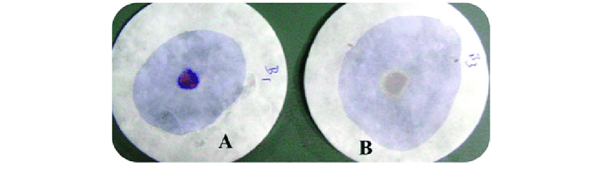 Oxidase test by Kovac’s method (Principle, Procedure, Result ...